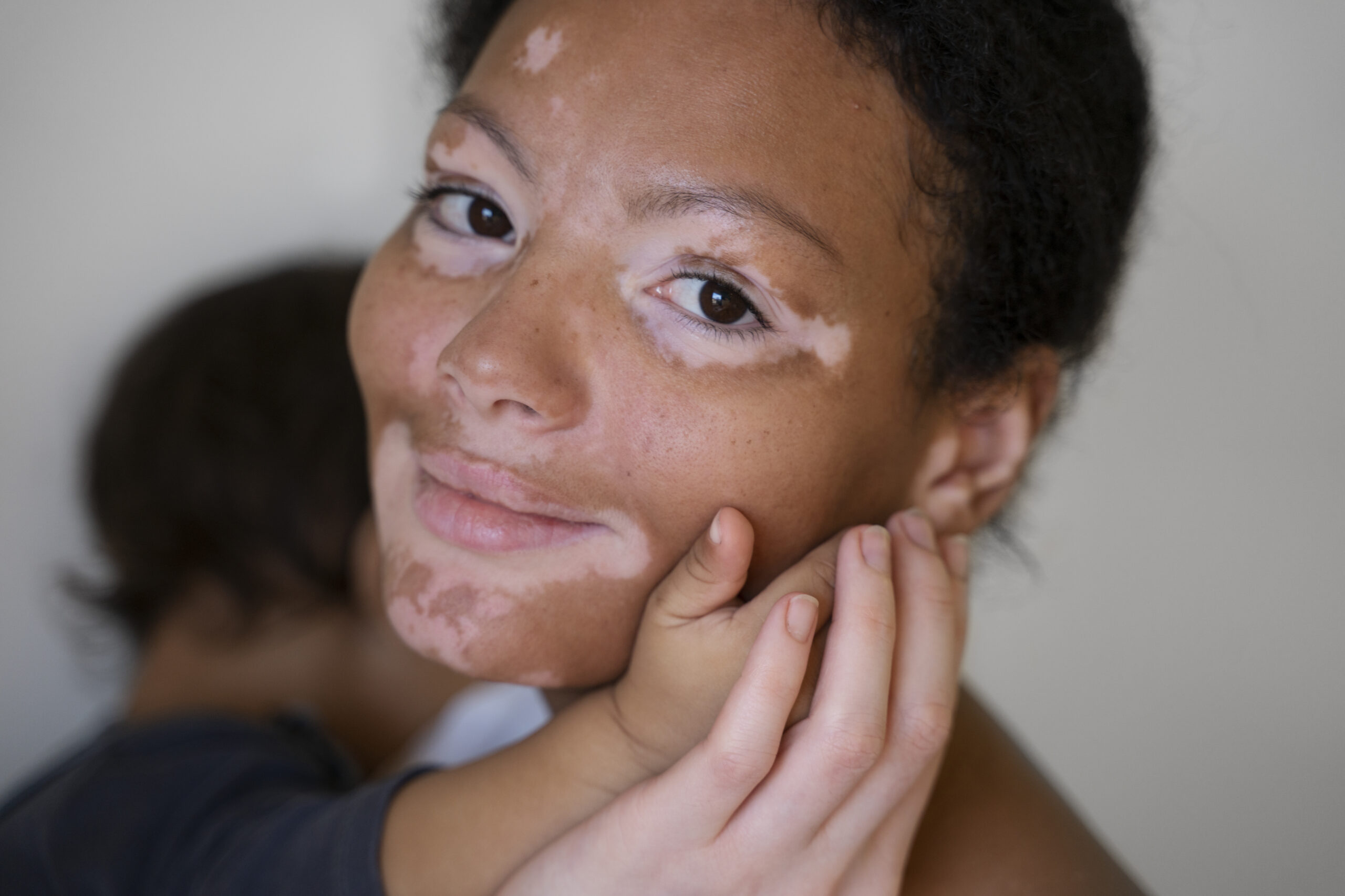 Preventing and Managing Skin Conditions in South Africa - Health